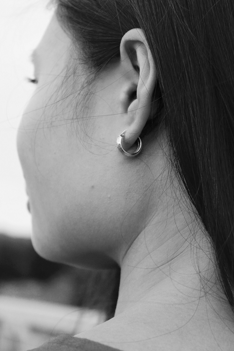 Otoplasty: Your Path to Confident Ears