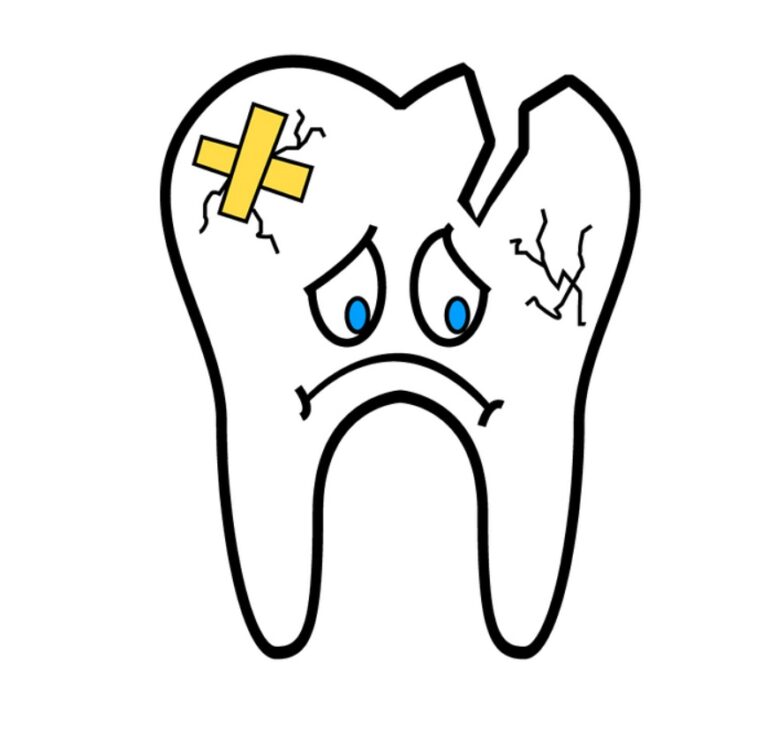 Fractured Tooth: 6 Symptoms And Treatment Options