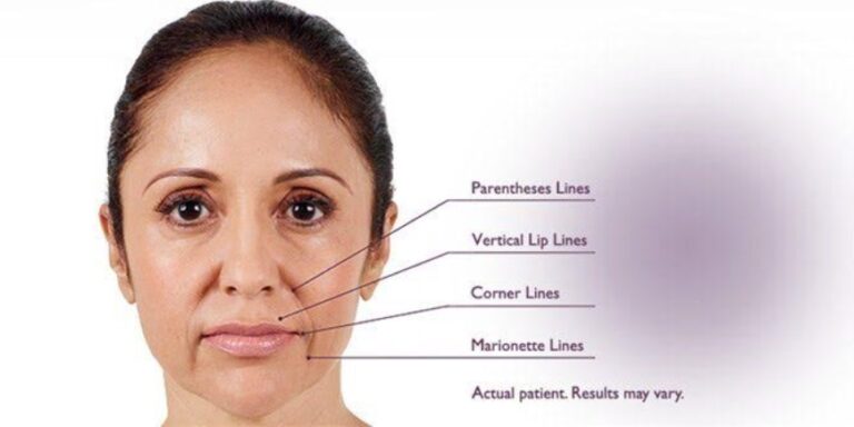 The Science Behind Botox: Understanding its Medical and Aesthetic ...