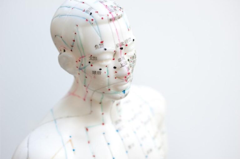 How Acupuncture Can Help Your Lower Back Pain