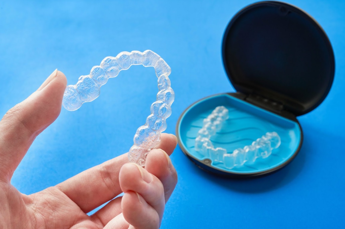 Cost of Invisalign: Is it Worth the Investment?
